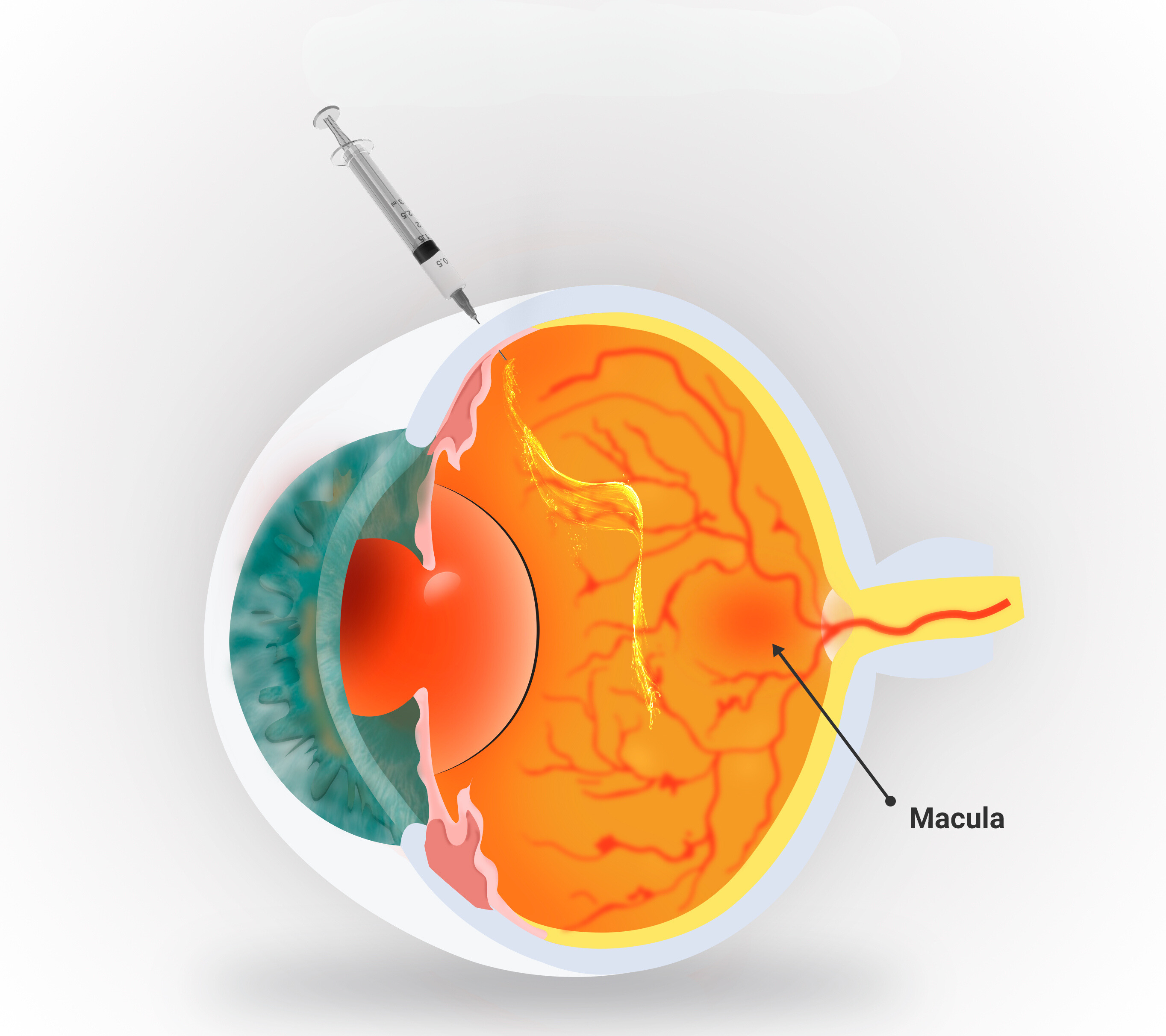 Op weg naar een behandelplan voor Geografische Atrofie - Oogfonds